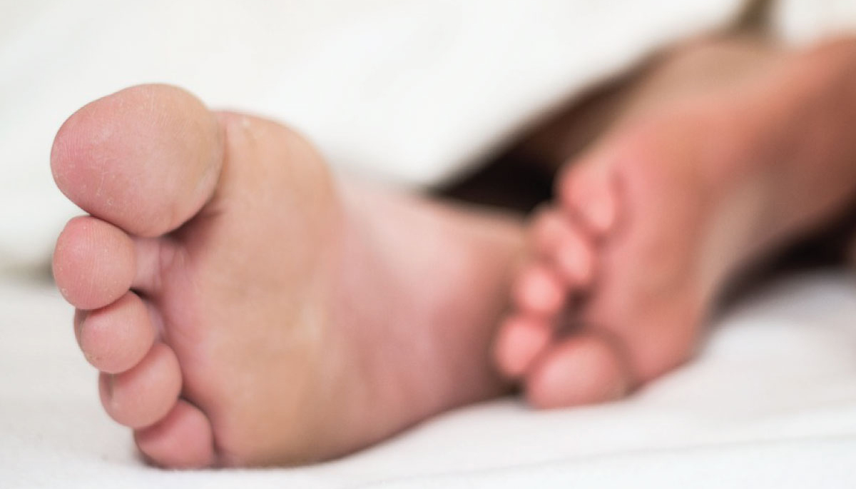 Foot Calluses Treatment and Facts